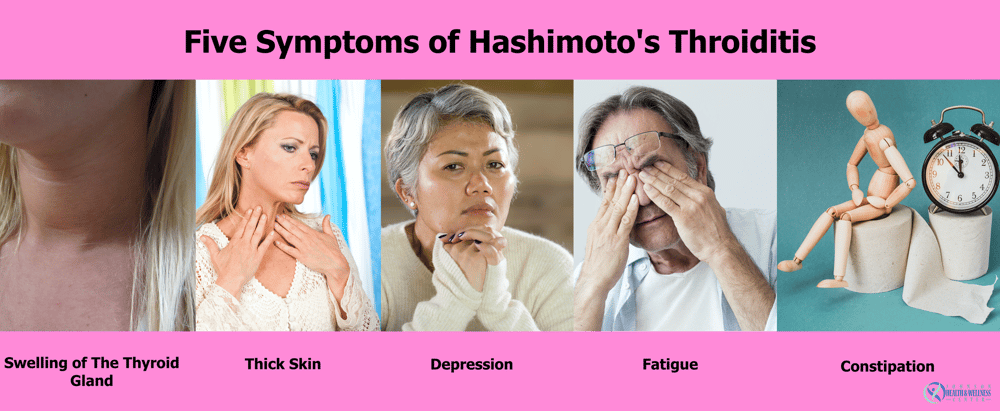 5 Symptoms of Hashimoto's Thyroid