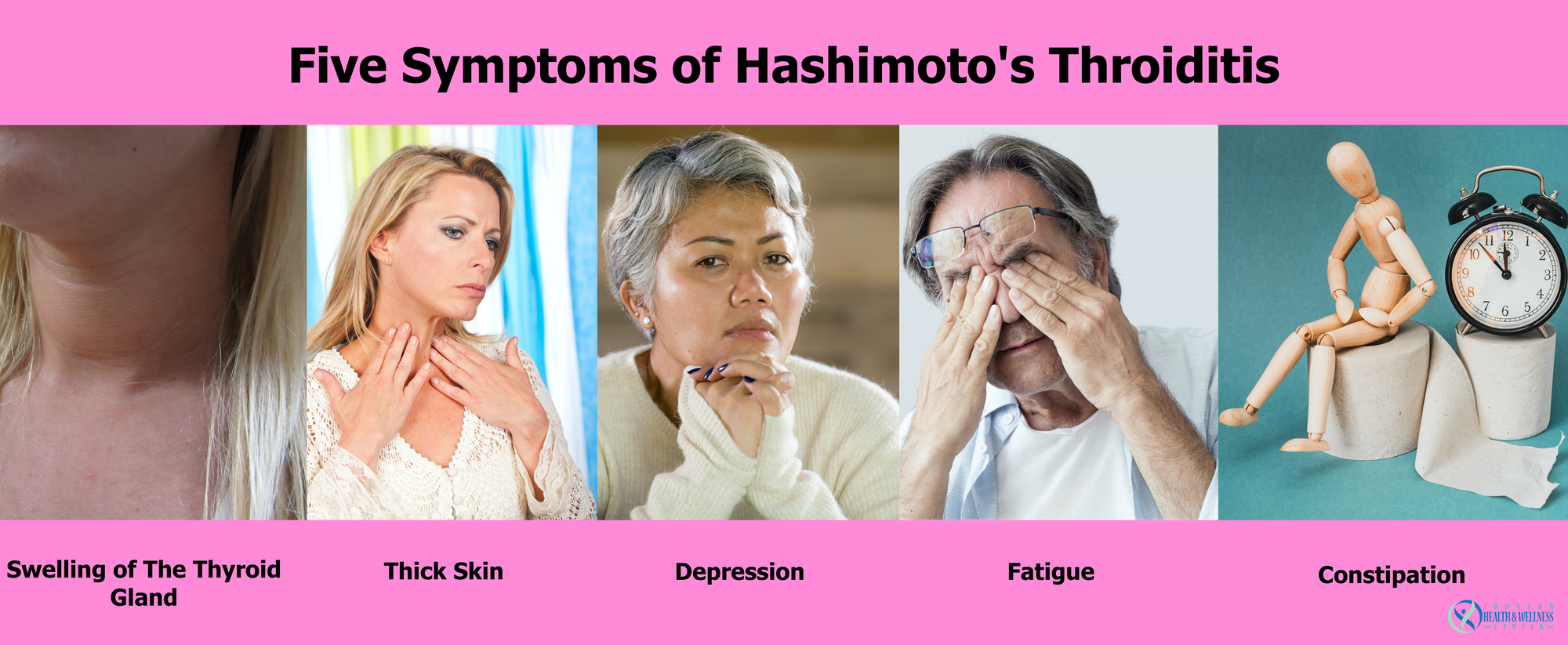 5 Symptoms of Hashimoto's Thyroid